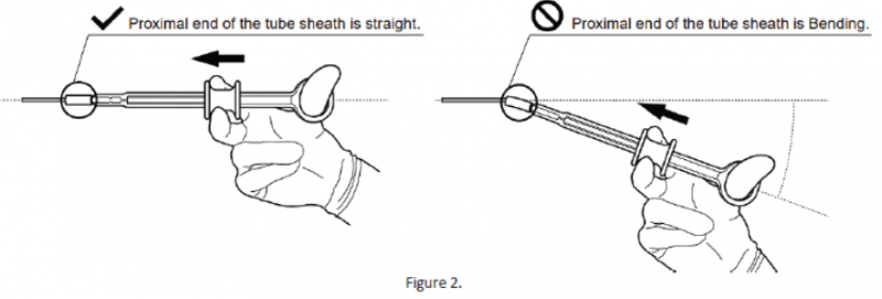 FDA issues warning about Olympus ligating devices after 113 injuries