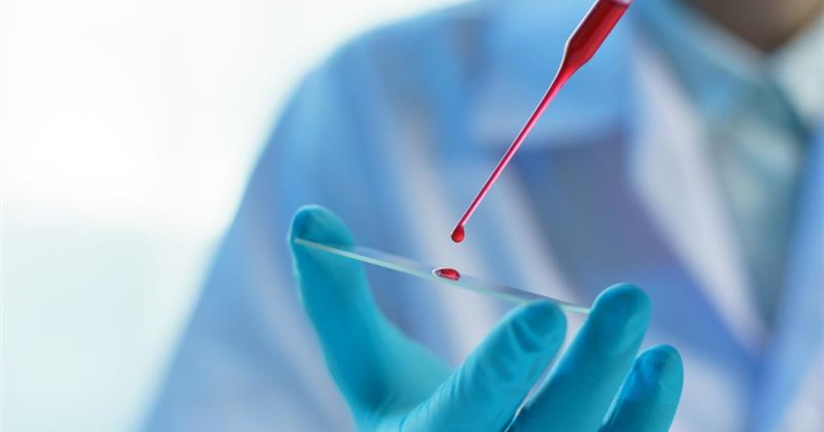 Labcorp expands use of digital pathology with renewed PathAI partnership