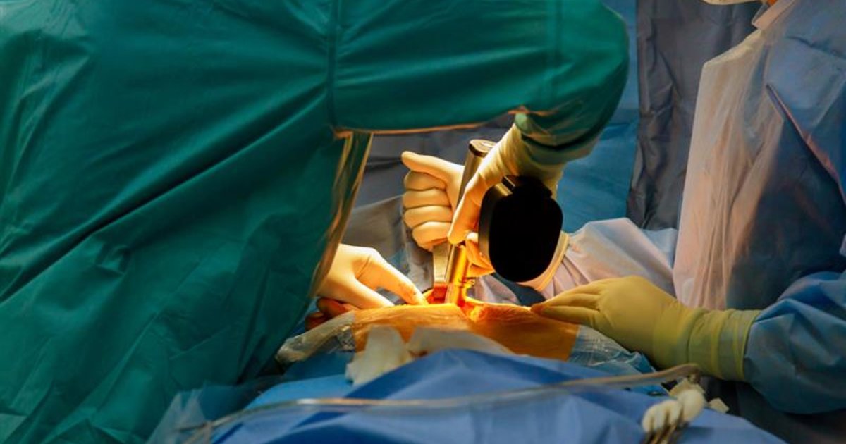 10-inch surgical instrument left inside cancer patient’s abdomen ...