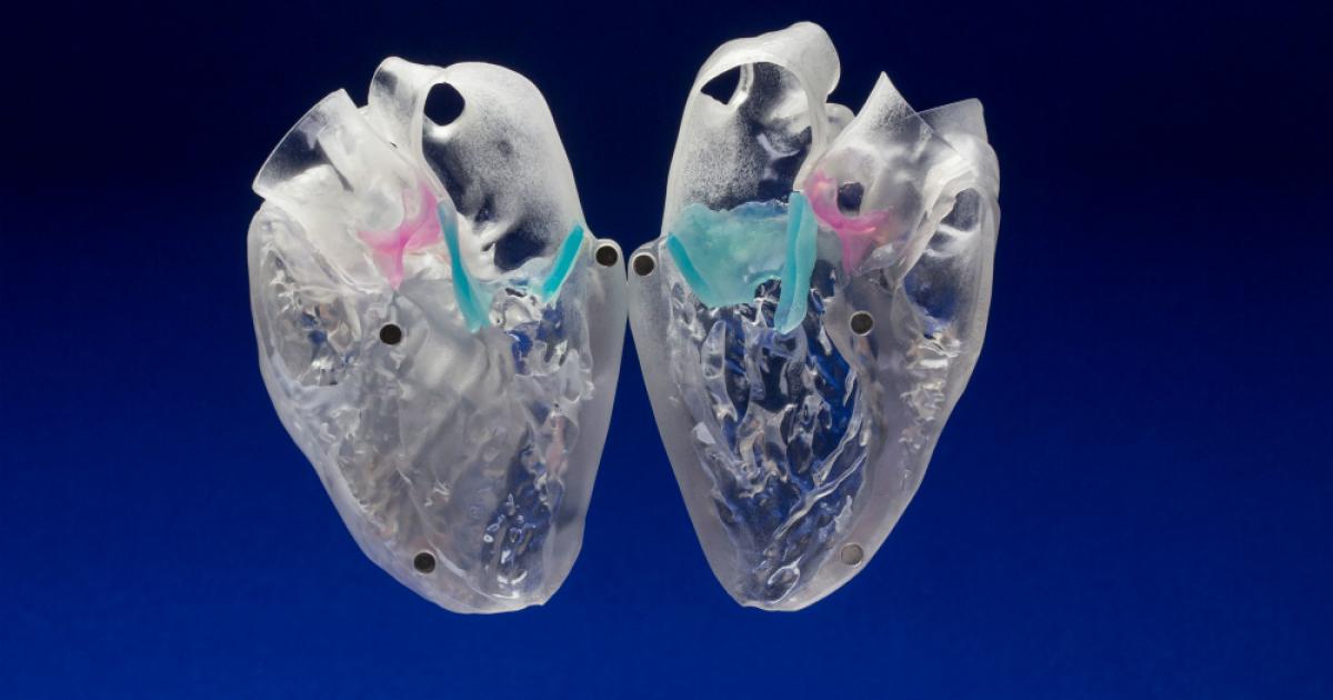 3D-printed models for heart valve disease predict leaks in TAVR