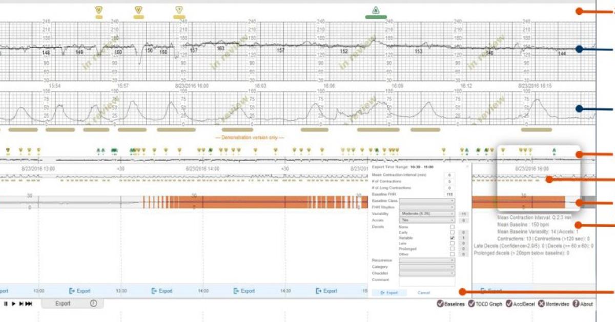 PeriGen acquires WatchChild, diversifies offerings in fetal ...